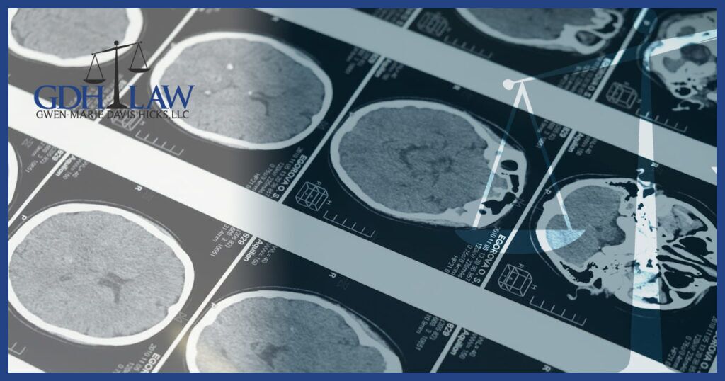 How a Traumatic Brain Injury (TBI) Can Change Your Life - GDH Law Firm